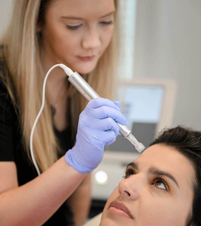 Exceed™ Microneedling - 67 Degrees Cosmetic Clinic